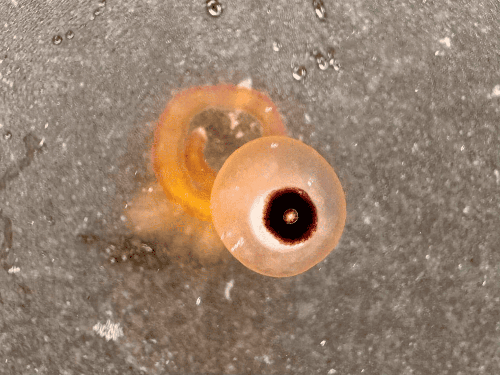 Stinging "Spaghetti Monsters" Wash Up On Texas Beaches - Wildwood Video ...